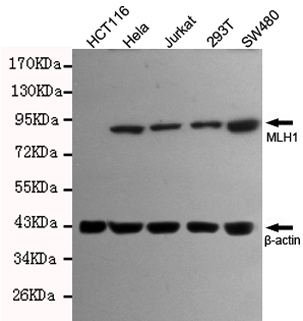 MLH1 Ab - 上海埃必威生物技术有限公司