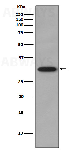 CDK2 Ab - 上海埃必威生物技术有限公司