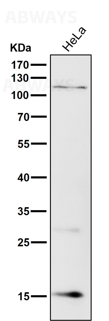CDKN2A Ab - 上海埃必威生物技术有限公司