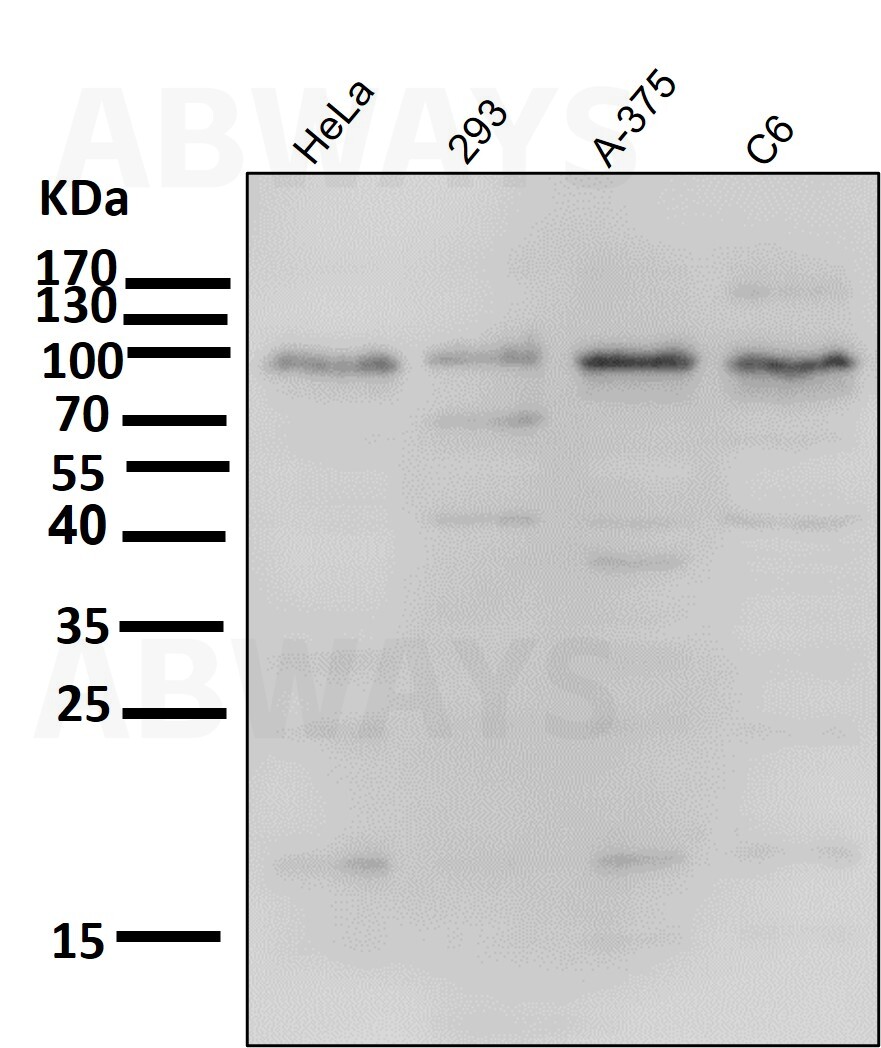 IKK alpha/beta Ab - 上海埃必威生物技术有限公司