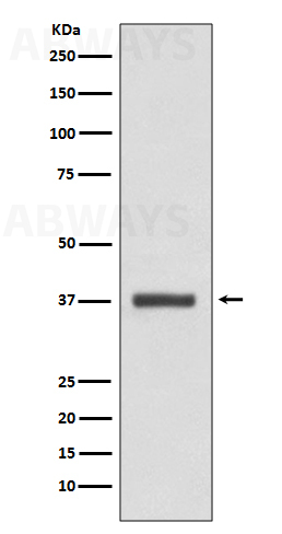 CDK6 Ab - 上海埃必威生物技术有限公司