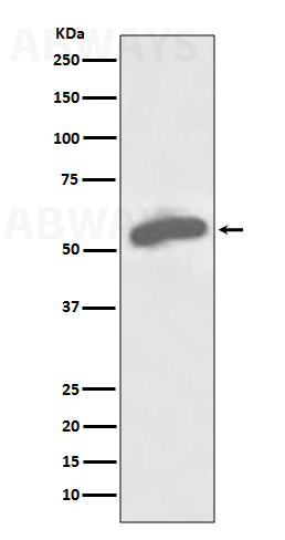 G6PD Ab - 上海埃必威生物技术有限公司