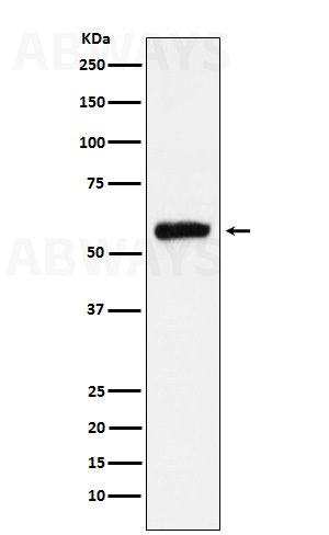 ALDH2 Ab - 上海埃必威生物技术有限公司