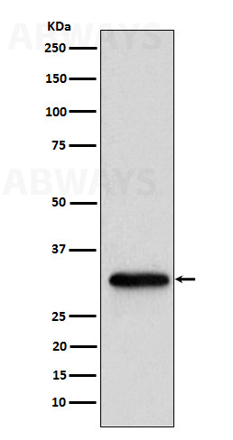NUDT5 Ab - 上海埃必威生物技术有限公司