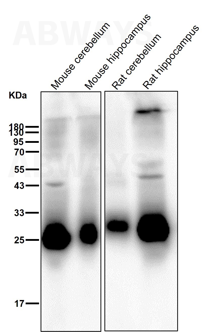 Rabbit monoclonal antibody - Abways